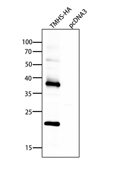 Anti-LHFPL5 | ABN2290-100UL